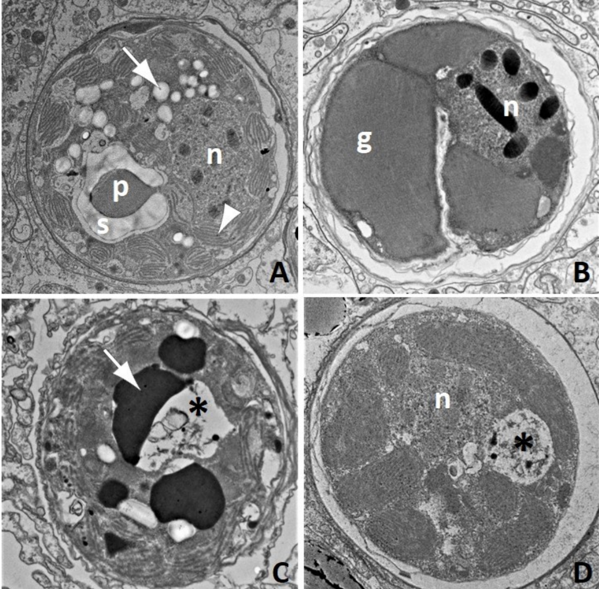 Electron Microscopy of Florida Corals Affected with SCTLD - Florida's ...